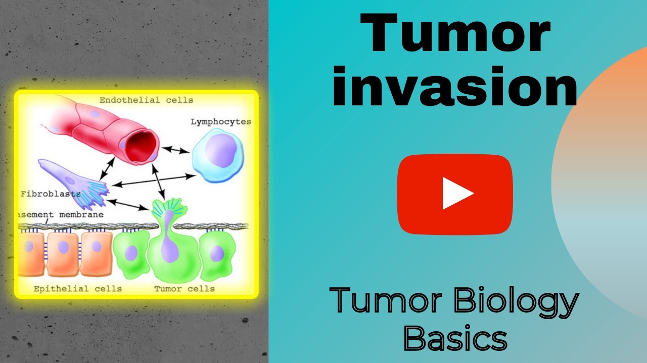 Tumor Invasion | Cancer Biology | Genesis Academy - YouTube