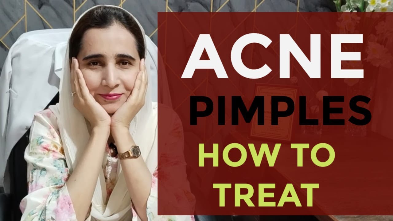Acne || Pimples || Food To Avoid || Easy Treatment || Explained By ...