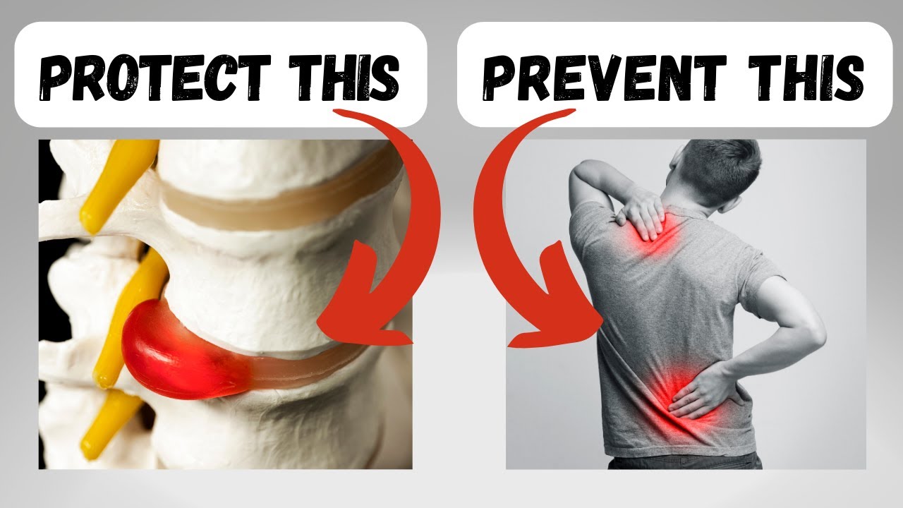 Escape the Pain: Discover Effective Solutions for Bulging Discs - YouTube