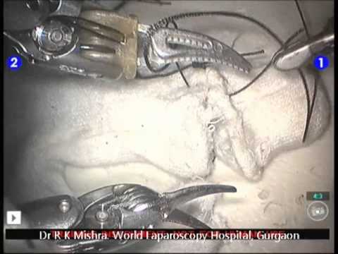 How to Practice Suturing on da Vinci Robot