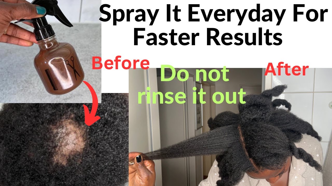 Overnight Hair Spray Most Powerful For Faster Hair Growth| Do Not Rinse ...