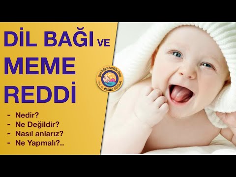 Bebeklerde Dil Bağı ve Beslenme Reddi
