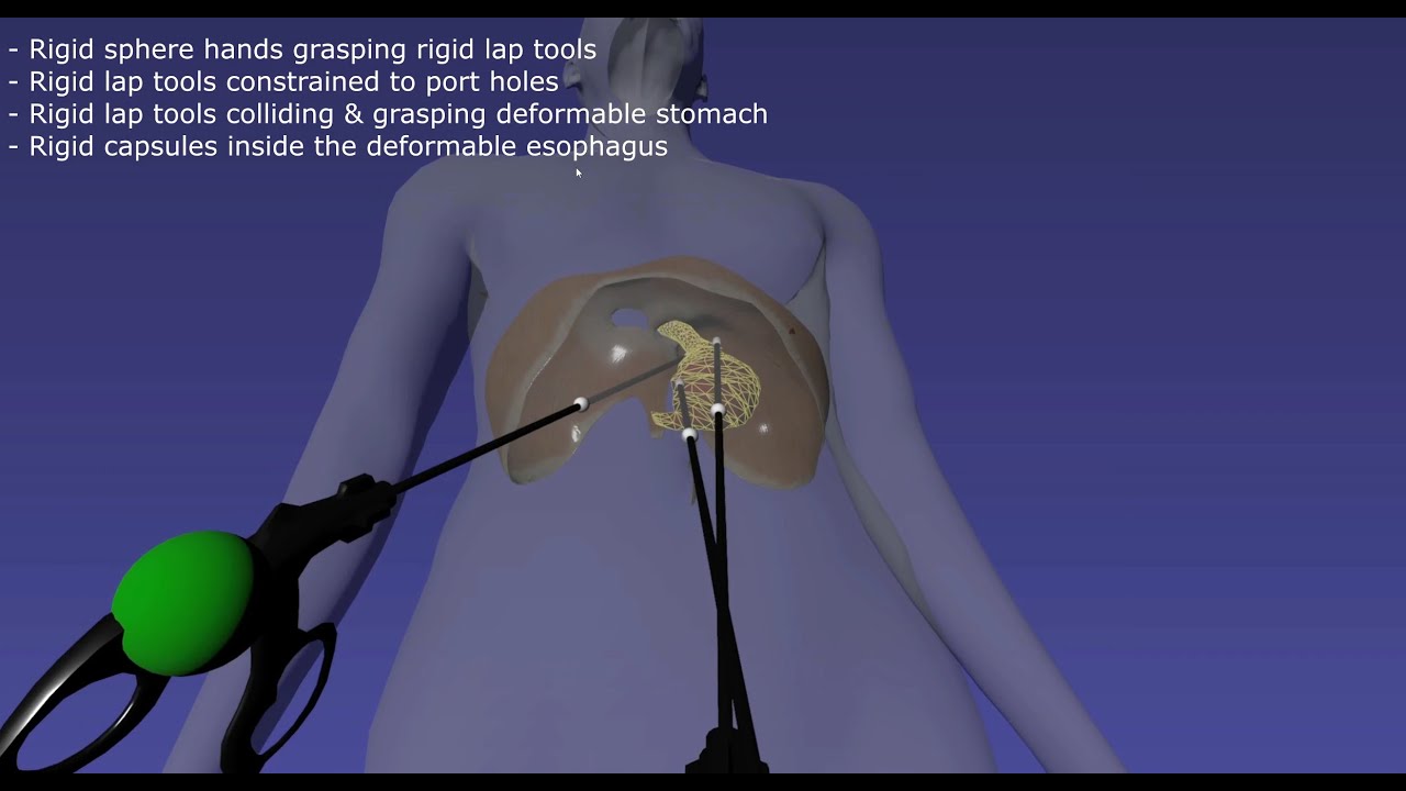 Surgical Simulation with Rigid Body Position Based Dynamics - YouTube