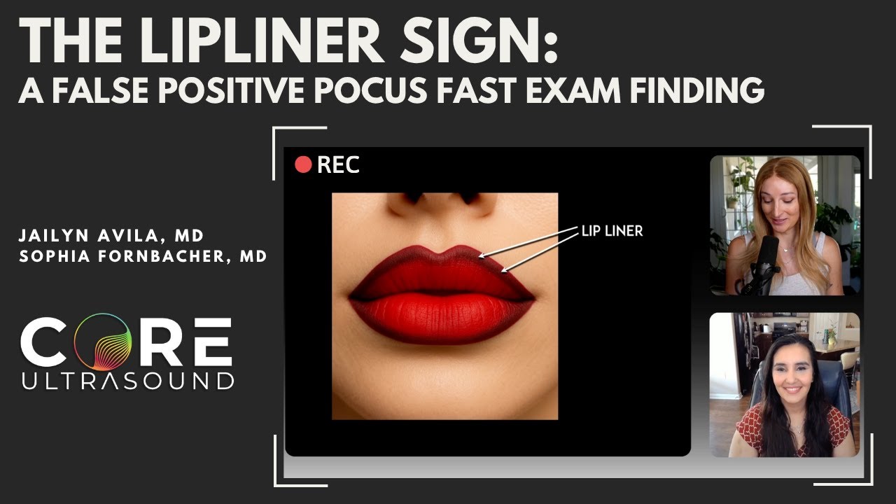 Exploring the Lip Liner Sign: Avoiding False Positives in FAST ...