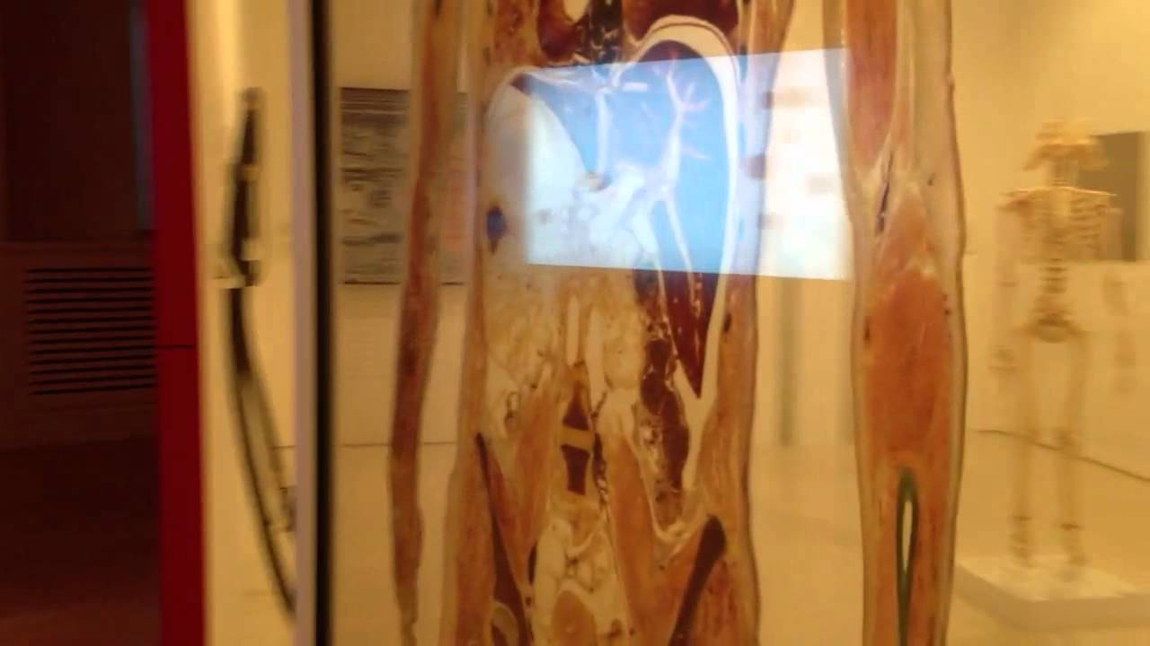 Human Slice - YouTube
