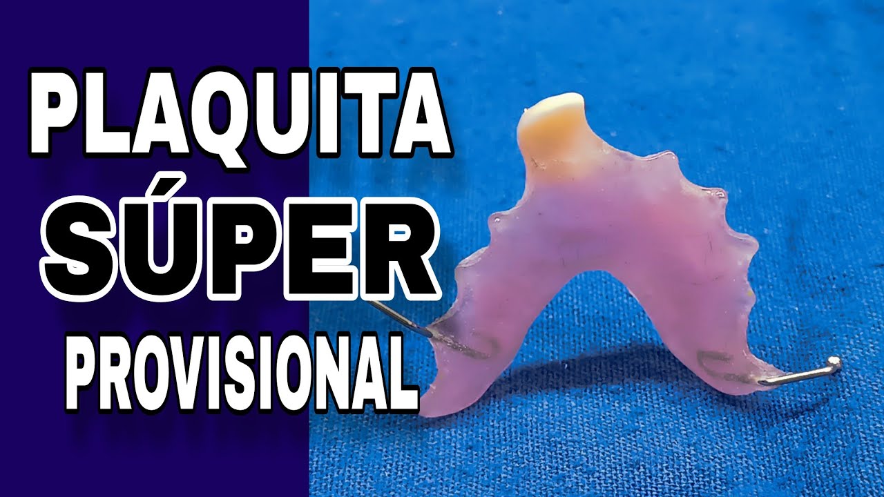 ¿CÓMO HACER UNA PRÓTESIS DENTAL PROVISIONAL PASO A PASO? : Útil y ...