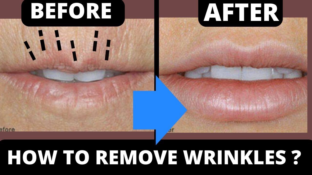 Erase Lip Lines Fast! Easy Face Exercises for Mouth Wrinkles | Lift ...