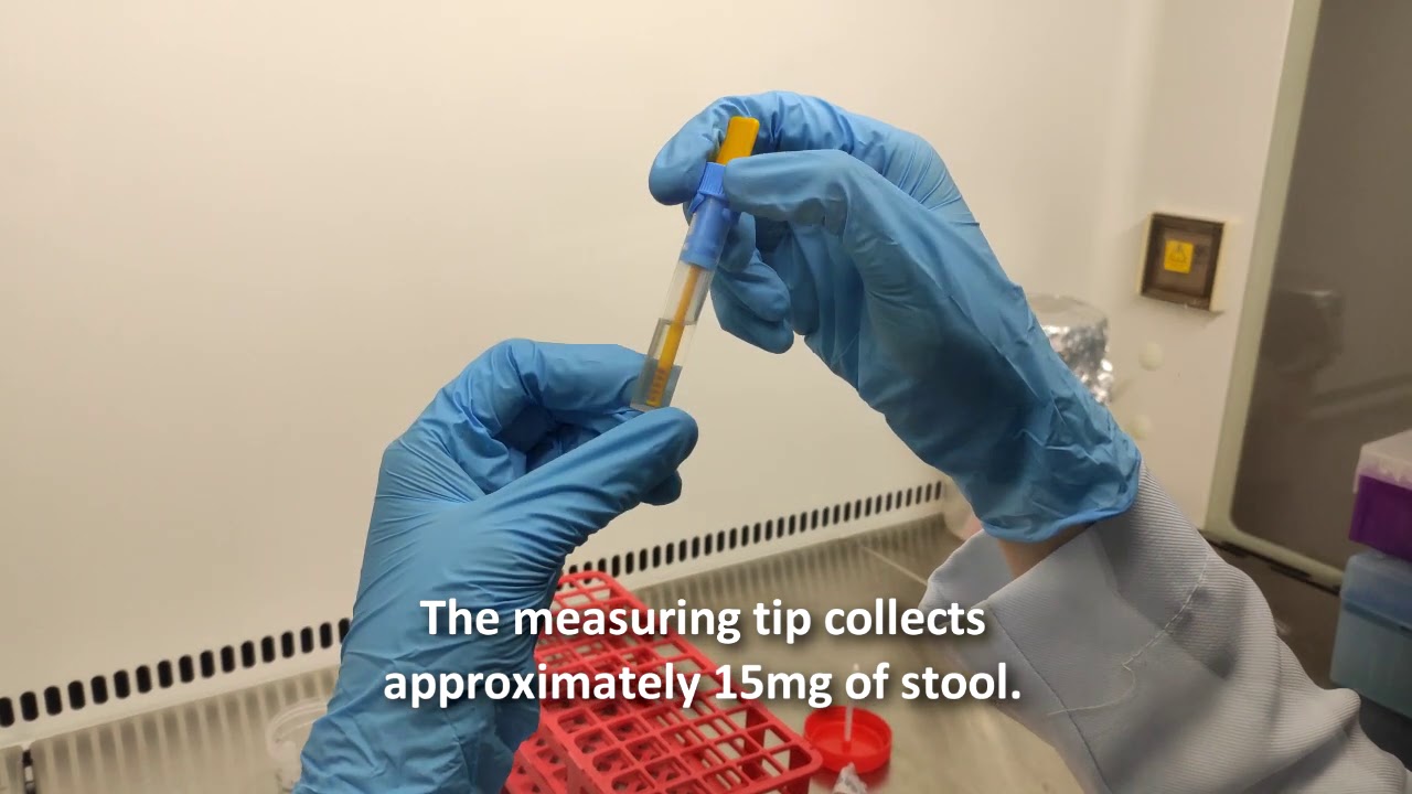MetaMetrics Laboratory: Fecal Calprotectin Sample Processing Video ...