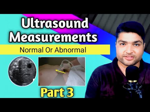 Mastering Ultrasound Measurements | A Comprehensive Guide to BPD, FL ...