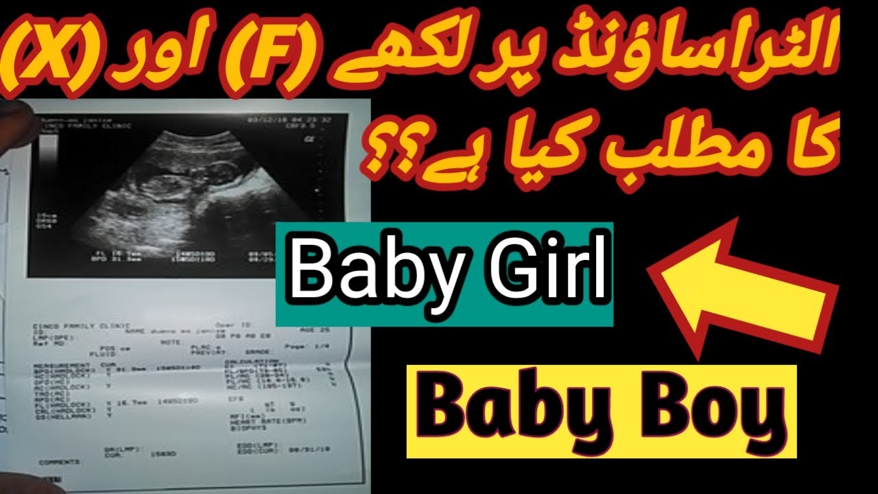 Baby Boy|Baby Girl|xx|xy|Radiology vibes - YouTube