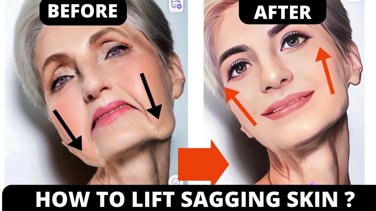 SAGGING CHEEKS AND SMILE LINES LIFTING ! FACE SMOOTHING EXERCISES ...