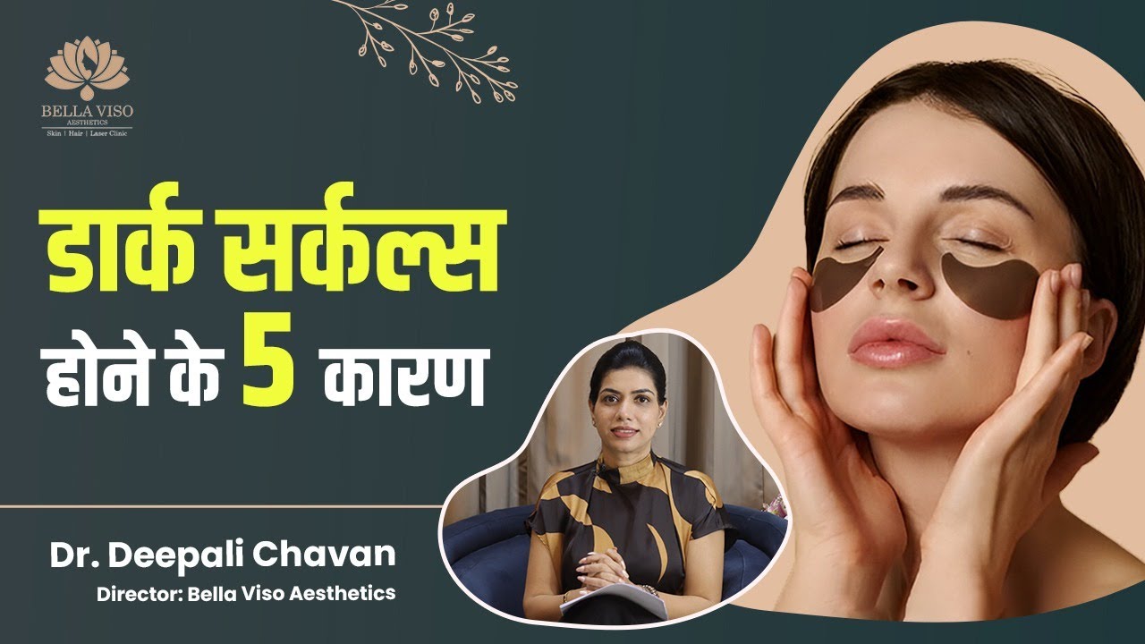 डार्क सर्कल्स होने के 5 कारण | 5 Causes of Dark Circles | Dr Deepali ...
