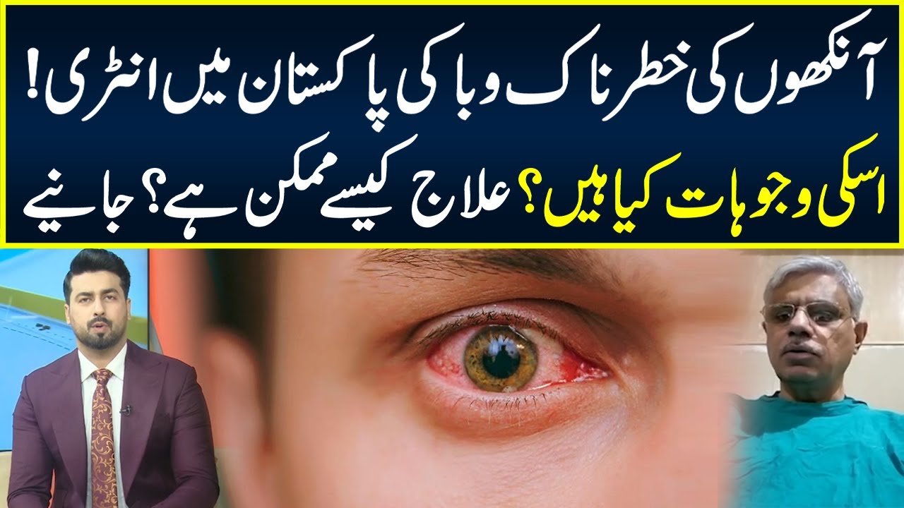 Symptoms and Treatment of Eye Infection | 18 Sep 2023 | Neo Pakistan ...