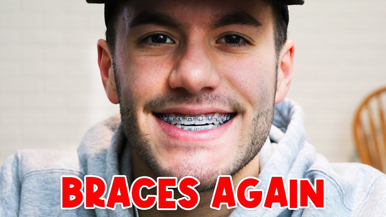 I GOT BRACES AGAIN.. - YouTube