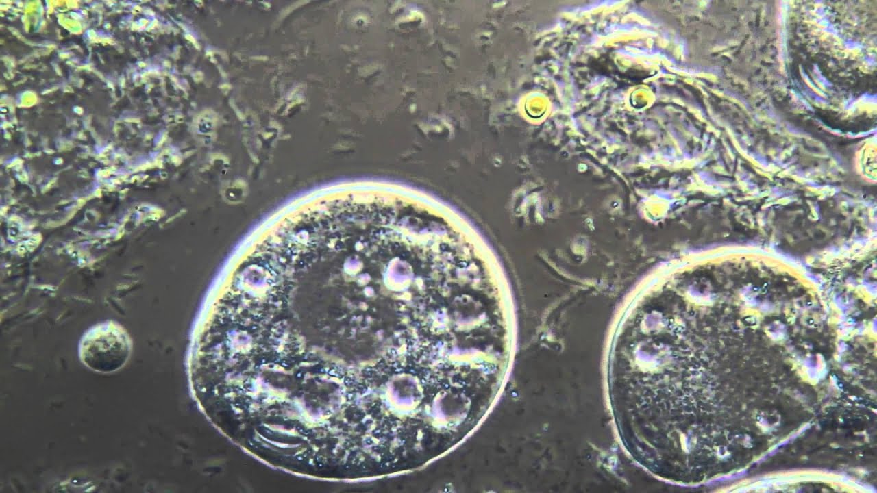 Colpidium 400x/Phase contrast - YouTube