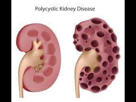 focus logic health tonic testimonial - YouTube