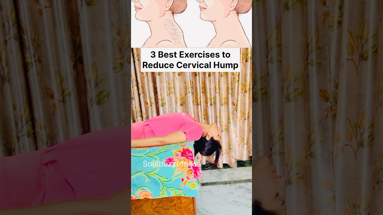 Reduce Cervical Hump ! #yogapractice #yoga #cervical #neckhump - YouTube