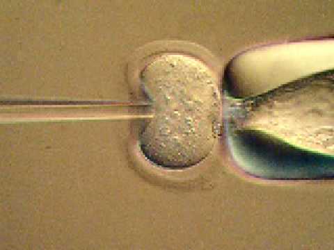 enucleation - YouTube