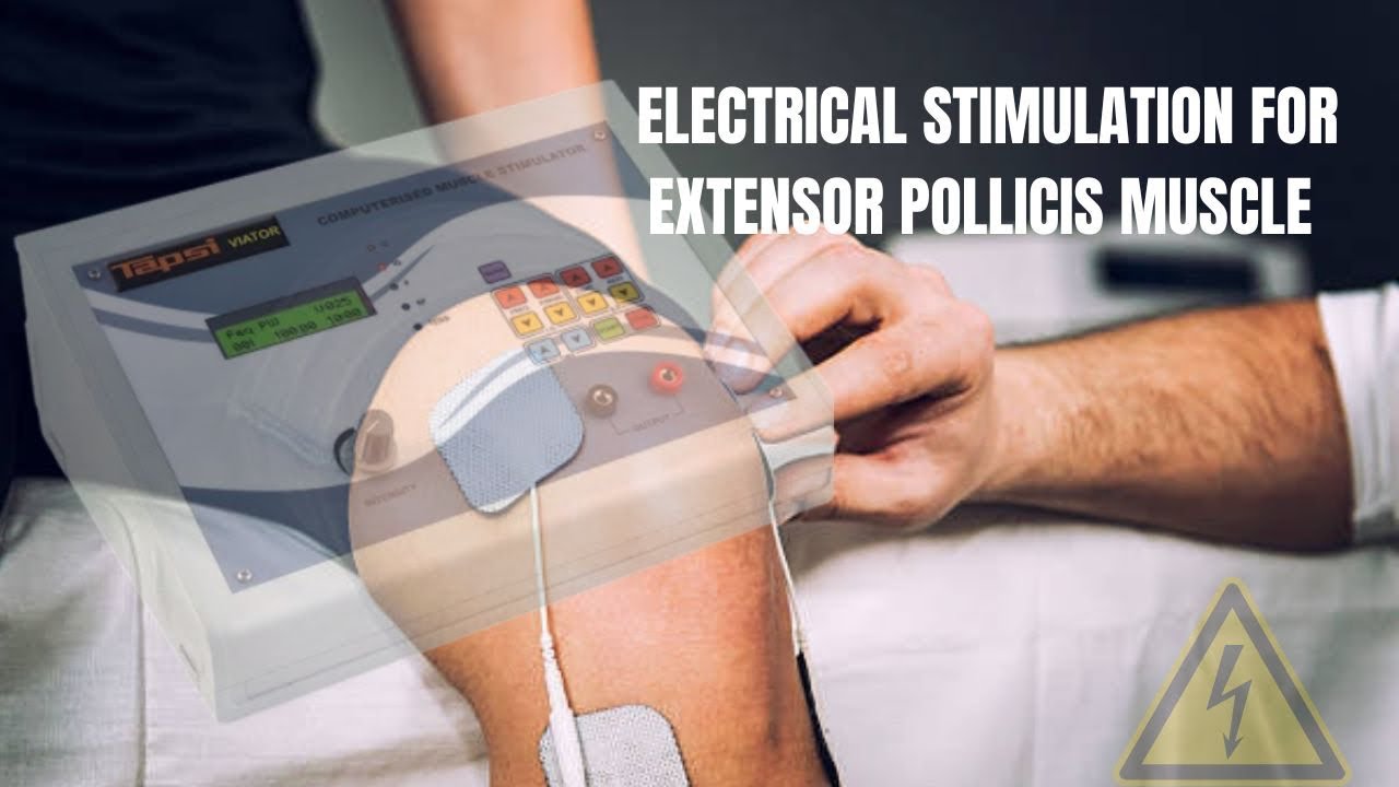 ELECTROTHERAPY/ELECTRICAL STIMULATION/MUSCLE-EXTENSOR POLLICIS - YouTube