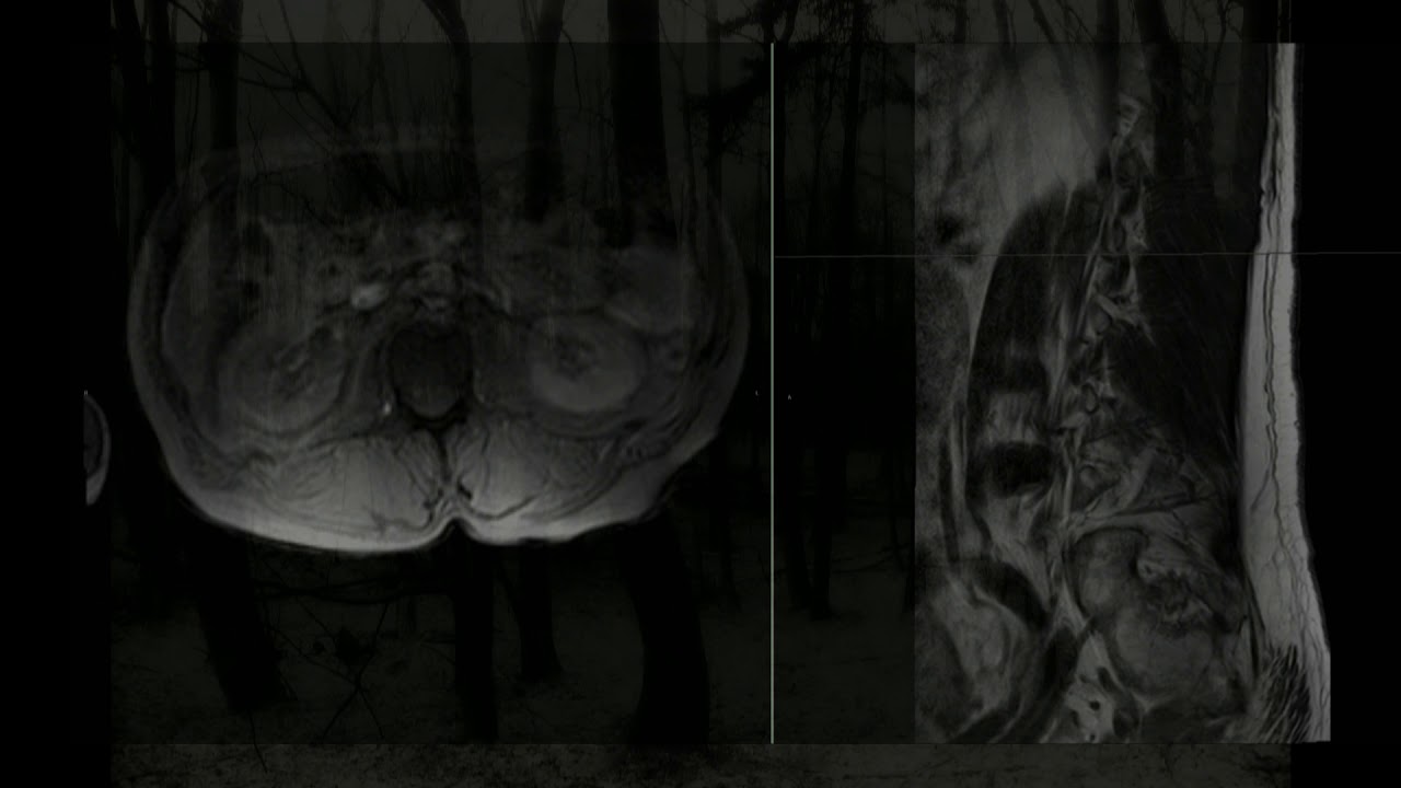 Steffen Lipski - Max Richter _ Twins MRT_Remake - YouTube