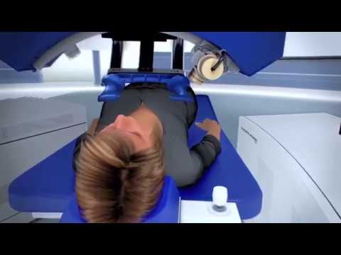Schwind Amaris Laser 1050 RS - YouTube