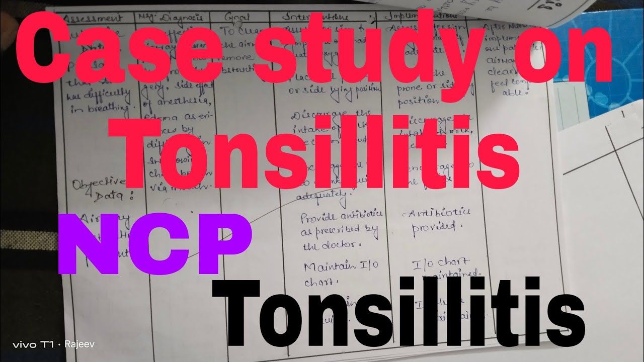 Case study on Tonsillitis #tonsillectomy #tonsillitis child health ...