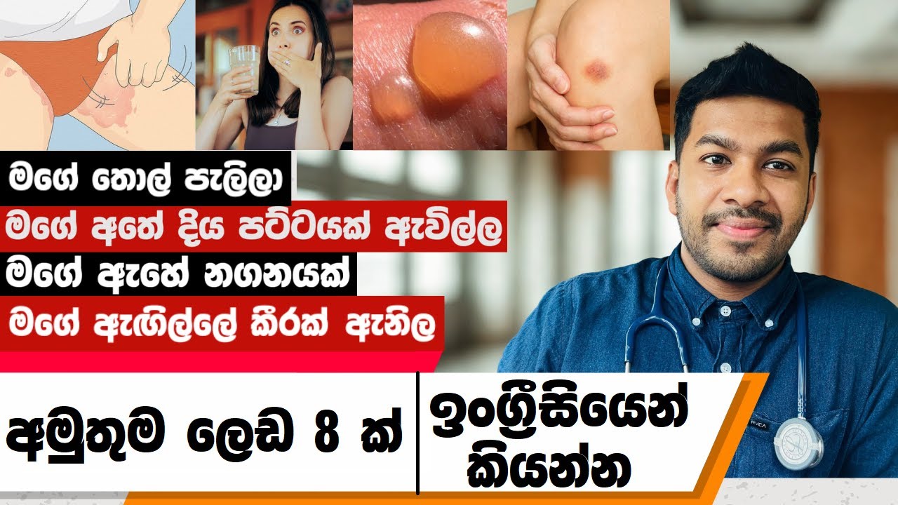 මේ ලෙඩවලින් කීයක් ඔයා ඉංග්‍රීසියෙන් කියන්න දන්නවද ? | Uncommon medical ...