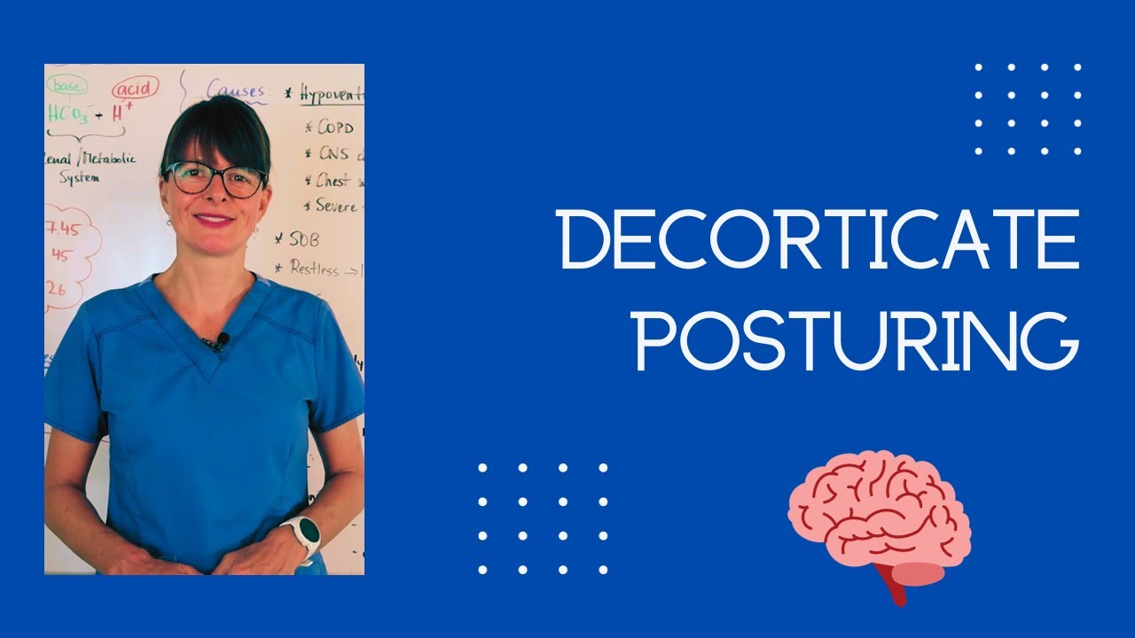 Decorticate Posturing #shorts - YouTube