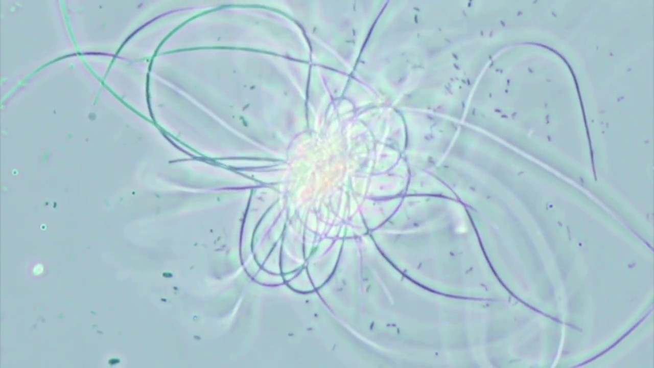 prokaryotic world - YouTube