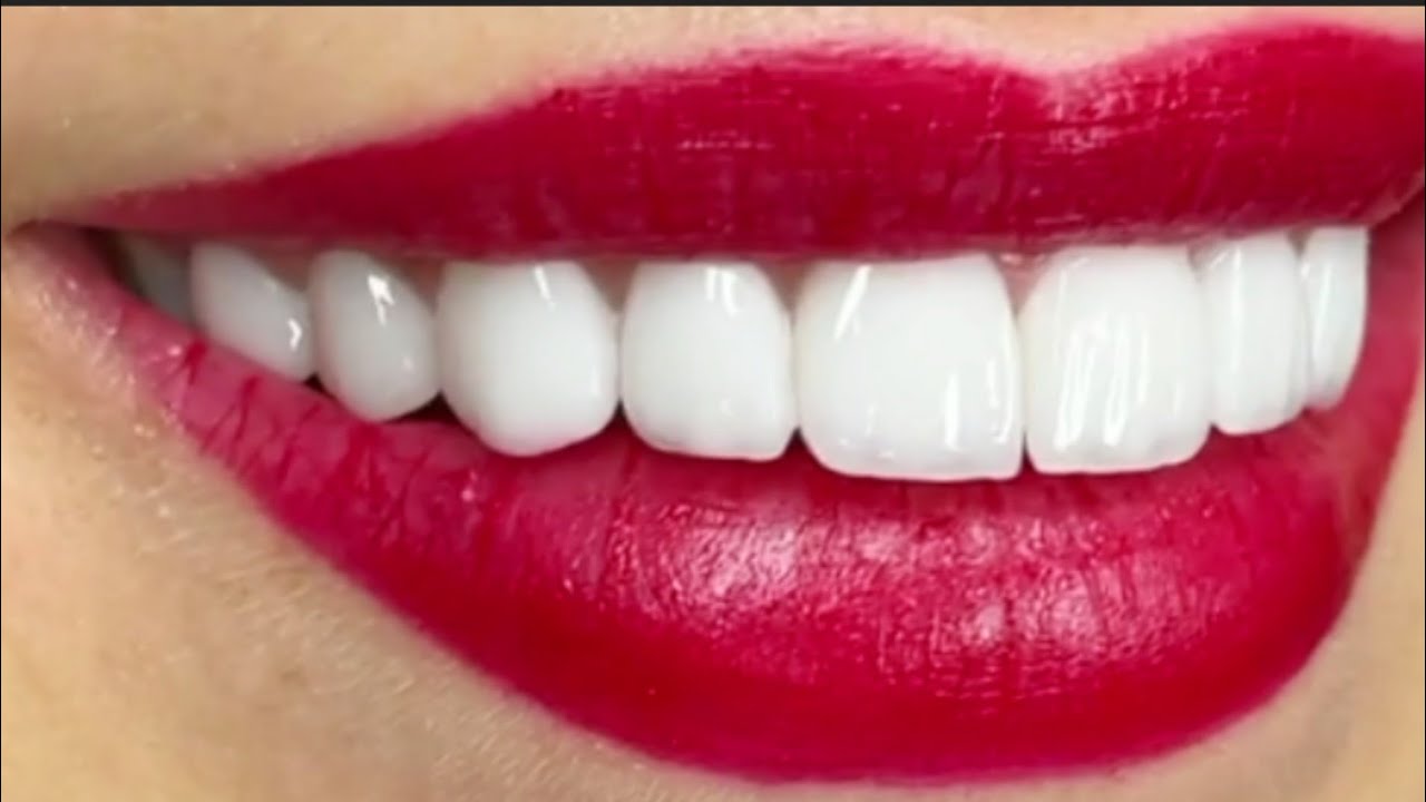 Close up Beautiful Teeth Girl || #dentistroom - YouTube
