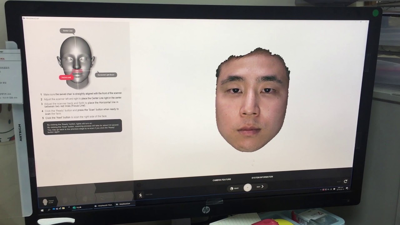 Preoperative simulation using Morpheus 3D scanner - YouTube