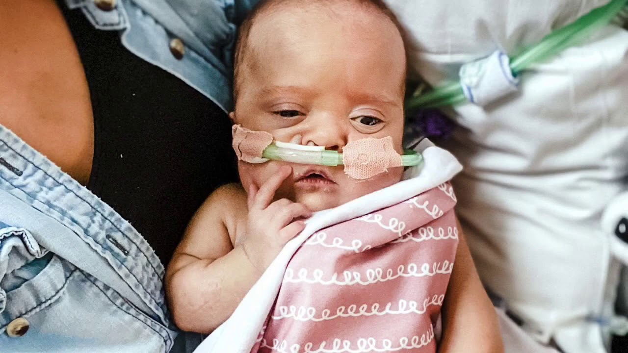 23 Weeker Twin reunited with her 22 Weeker Sister after 224 days in the ...