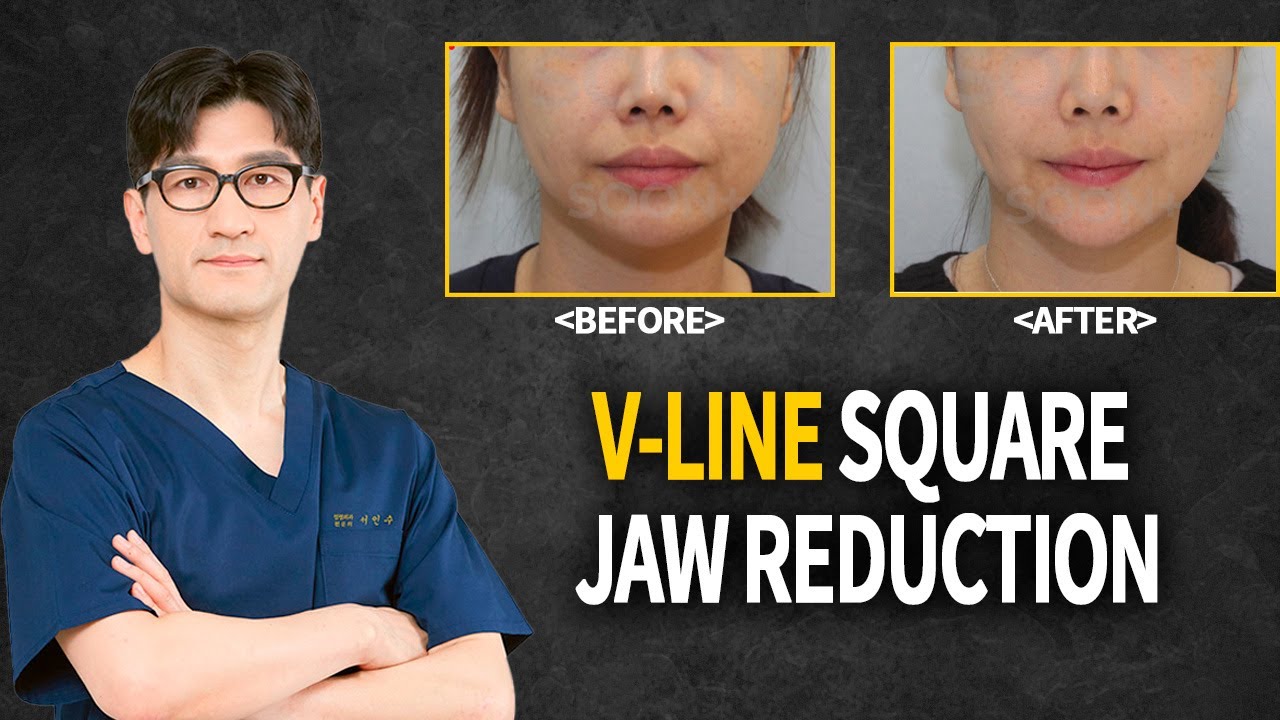Korean Plastic Surgery Jaw Shaving