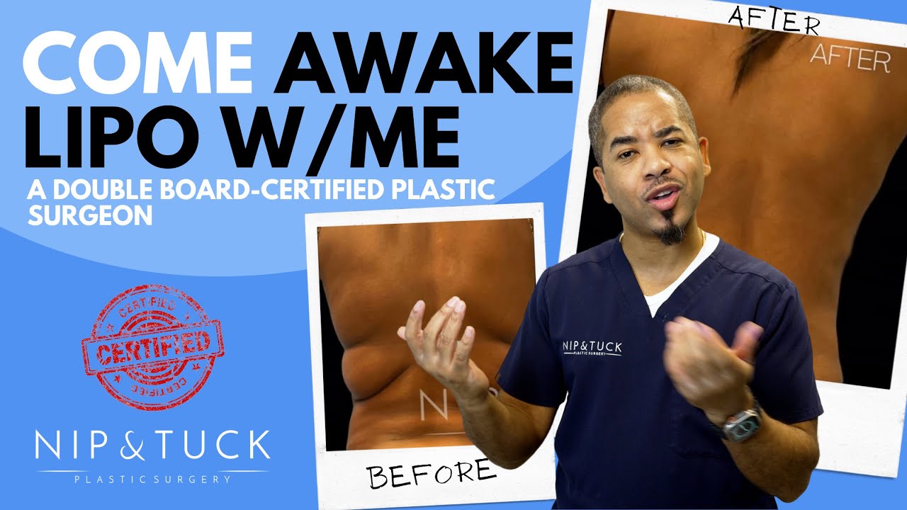 Come Awake Lipo with Me: Double Board-Certified Plastic Surgeon goes ...