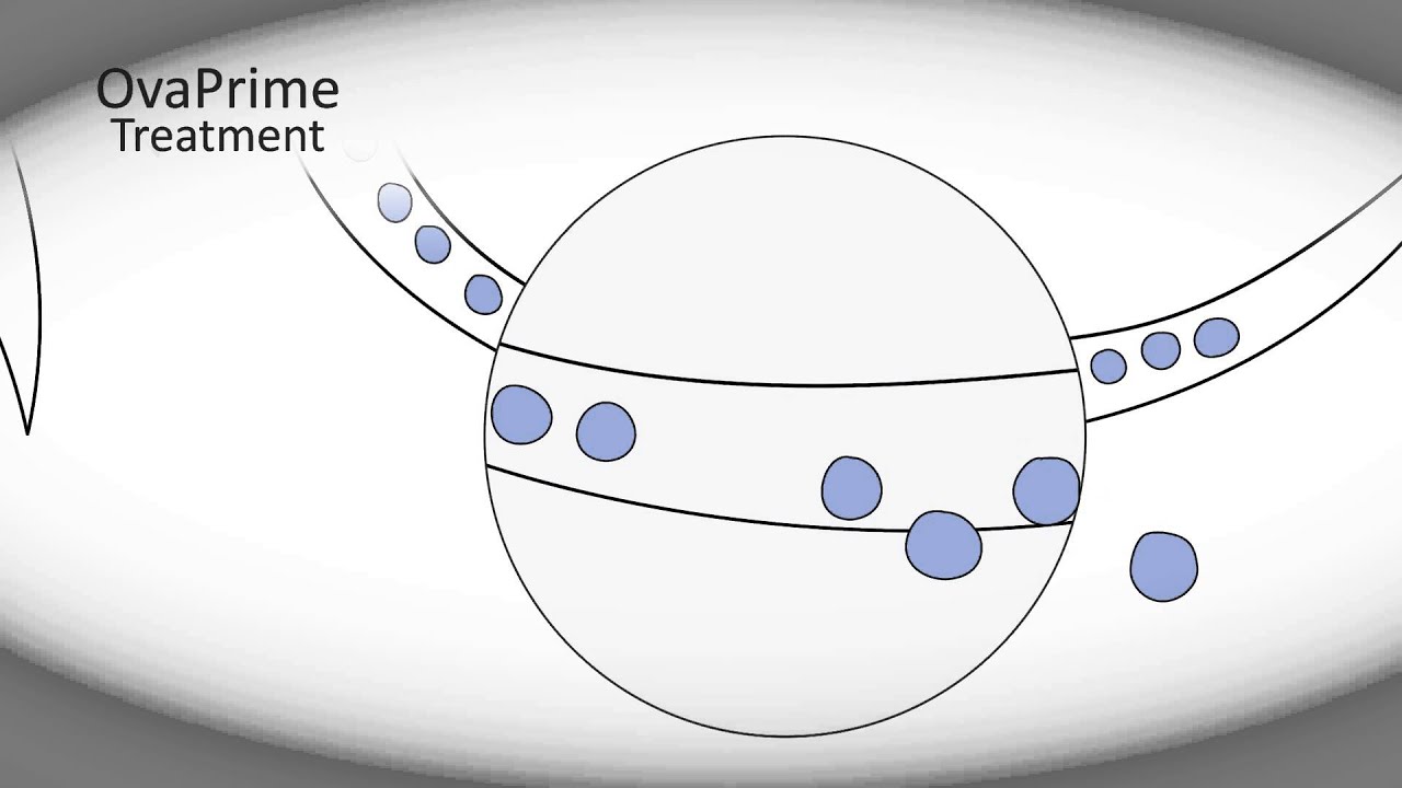 OvaScience Fertility Treatments - Whiteboard Video - YouTube