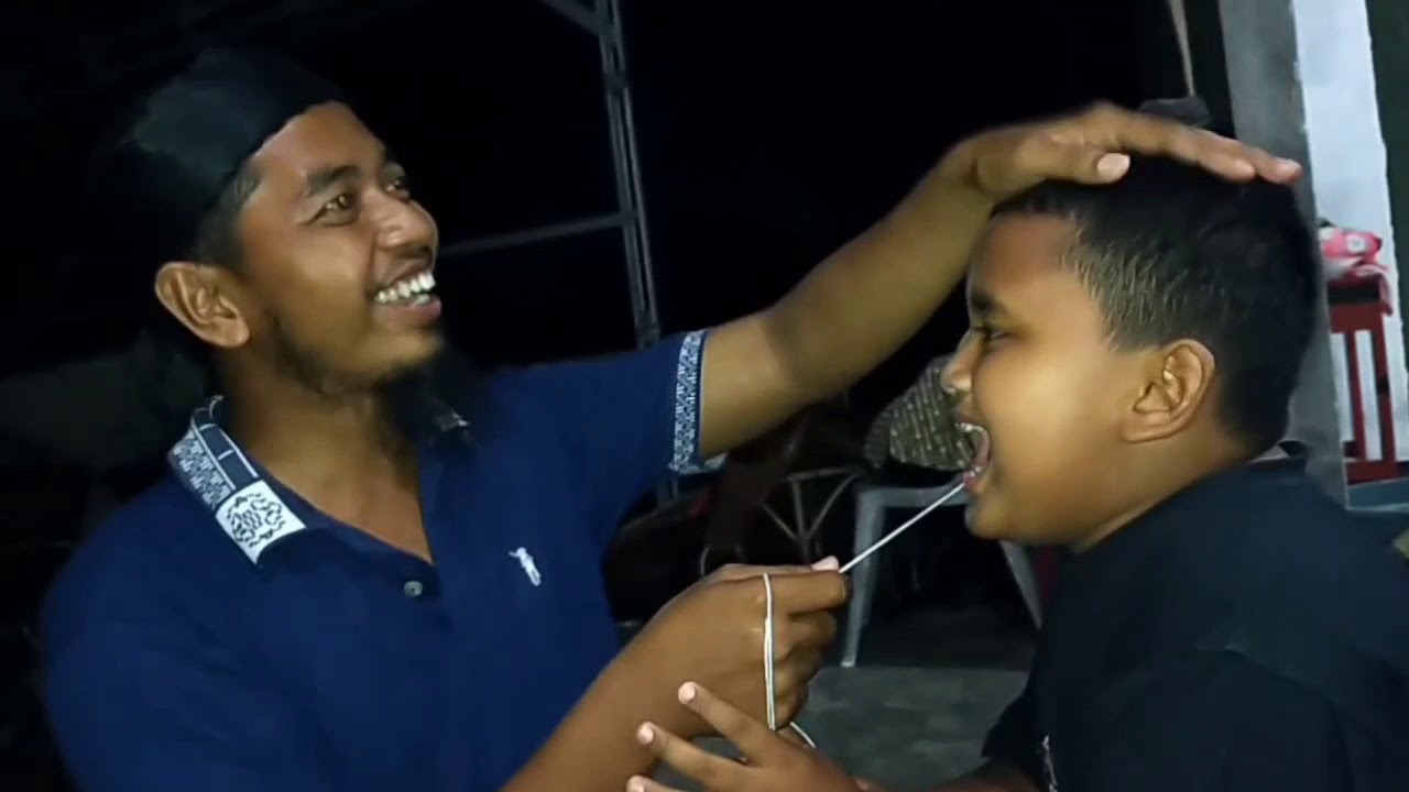 Tutorial cabut gigi pakai benang mudah dan tidak sakit. - YouTube