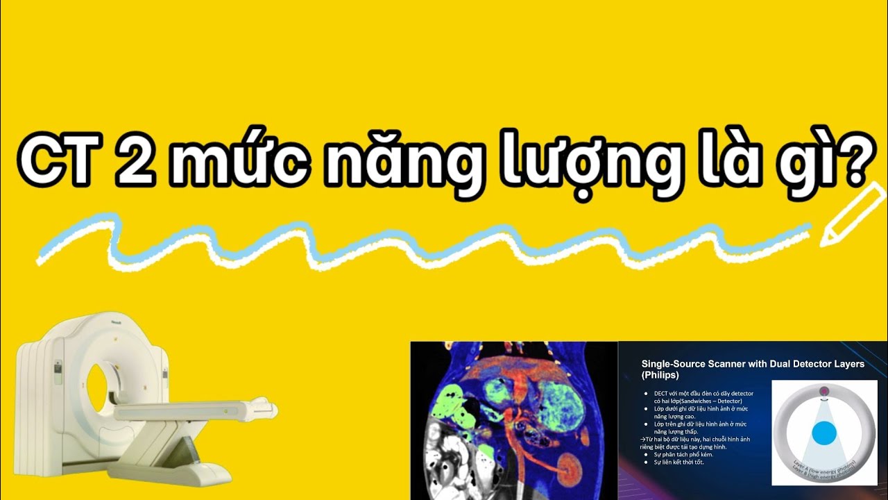CT 2 mức năng lượng ( Dual energy) - YouTube