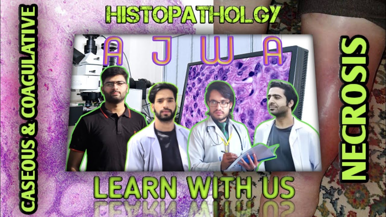 CASEOUS AND COAGULATIVE NECROSIS|HISTOLOGY MADE EASY| AYUB MEDICAL ...