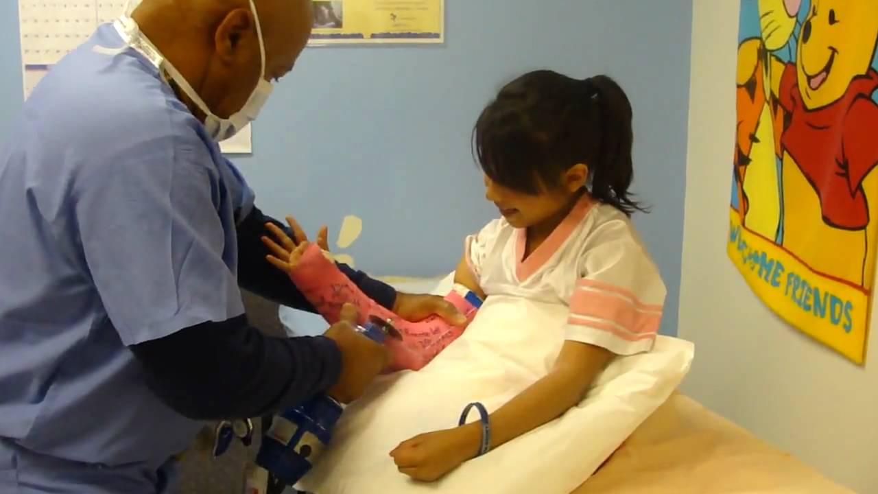 Broken Elbow cast taken off - YouTube