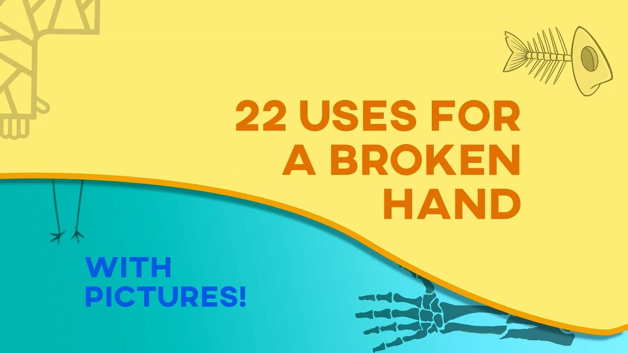22 Uses For A Broken Hand / Arm Thingy (WITH PICTURES) - YouTube