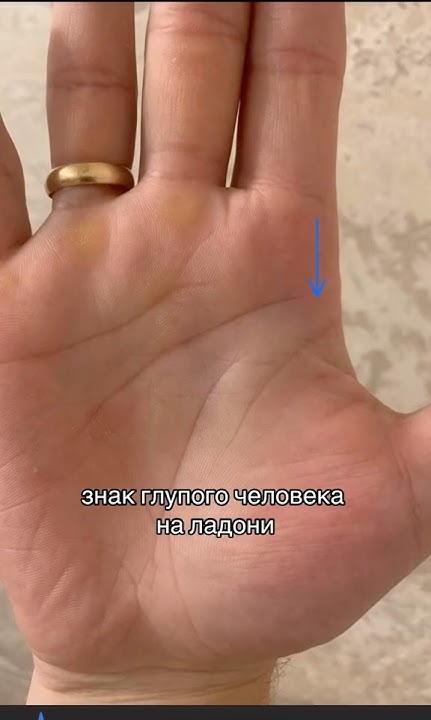 Знак глупого человека! #хиромантия #судьба - YouTube