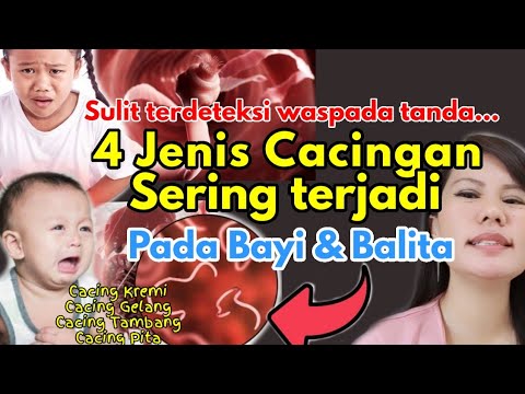 Tanda anak cacingan dan cara mengatasi anak cacingan