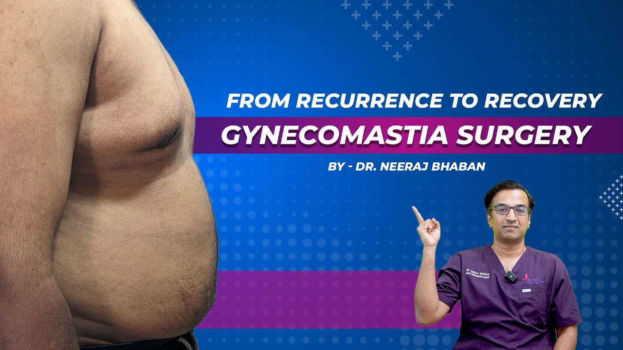 From Recurrence to Recovery: Gynecomastia Surgery Success Story - YouTube
