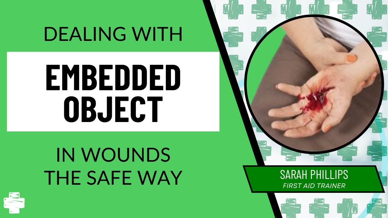 Treating Embedded Objects and Amputations - Step-by-Step Guide - YouTube