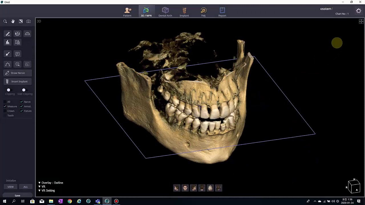 [One3] 3D&3D zoom 기능편 - YouTube