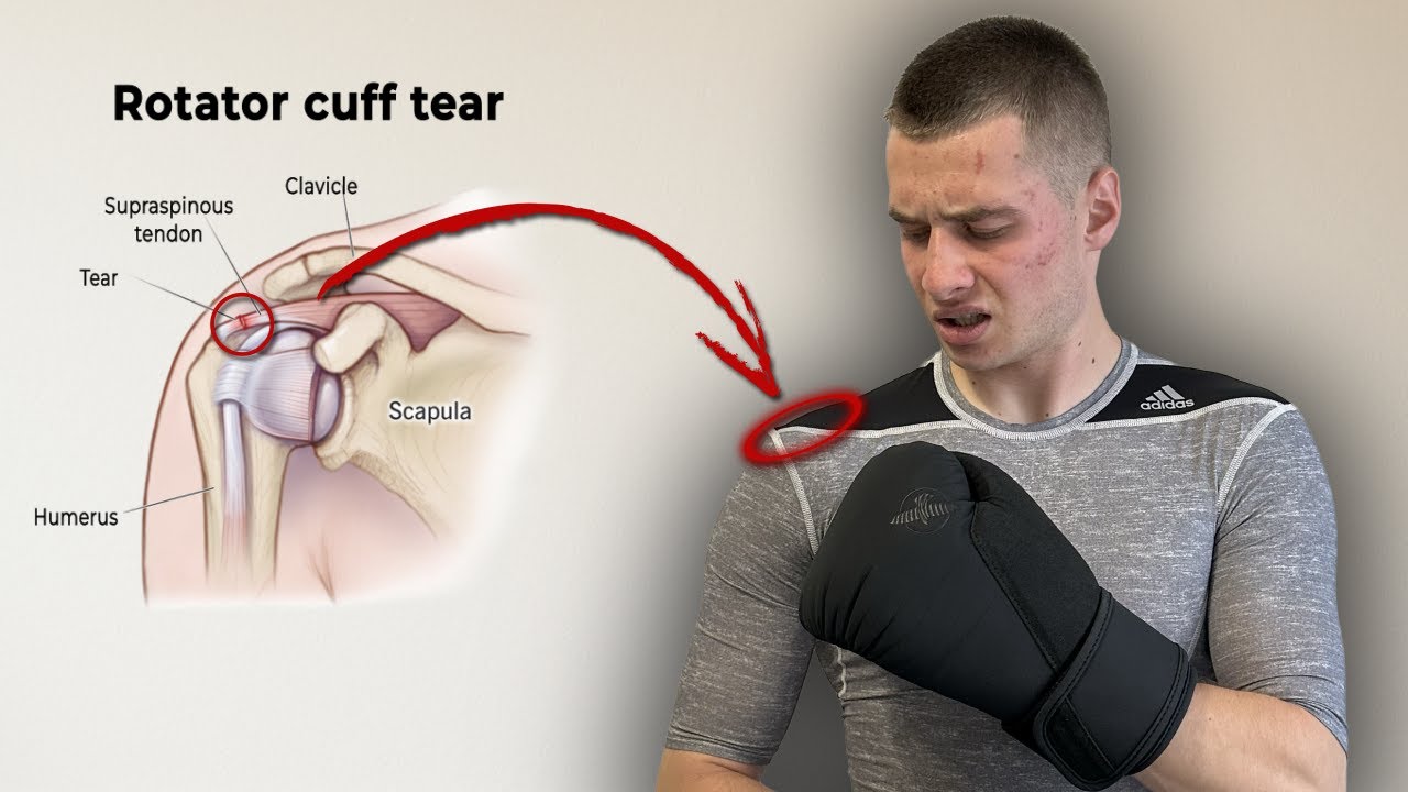 Fix Your Shoulder Pain from Boxing - YouTube