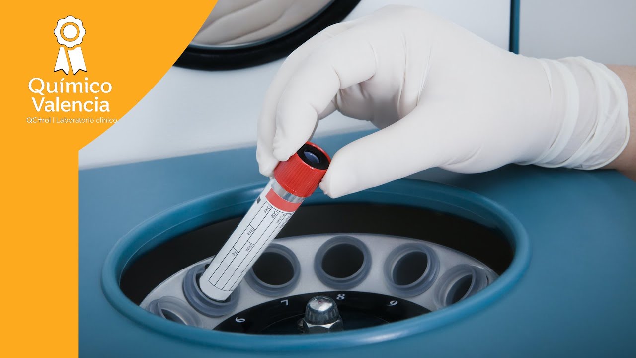 ¿Cómo CENTRIFUGAR las muestras de Laboratorio Clínico? - YouTube