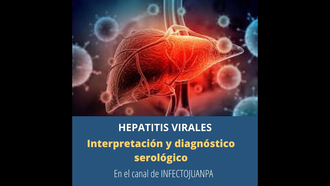 Hepatitis Virales. Interpretación y diagnóstico serológico - YouTube