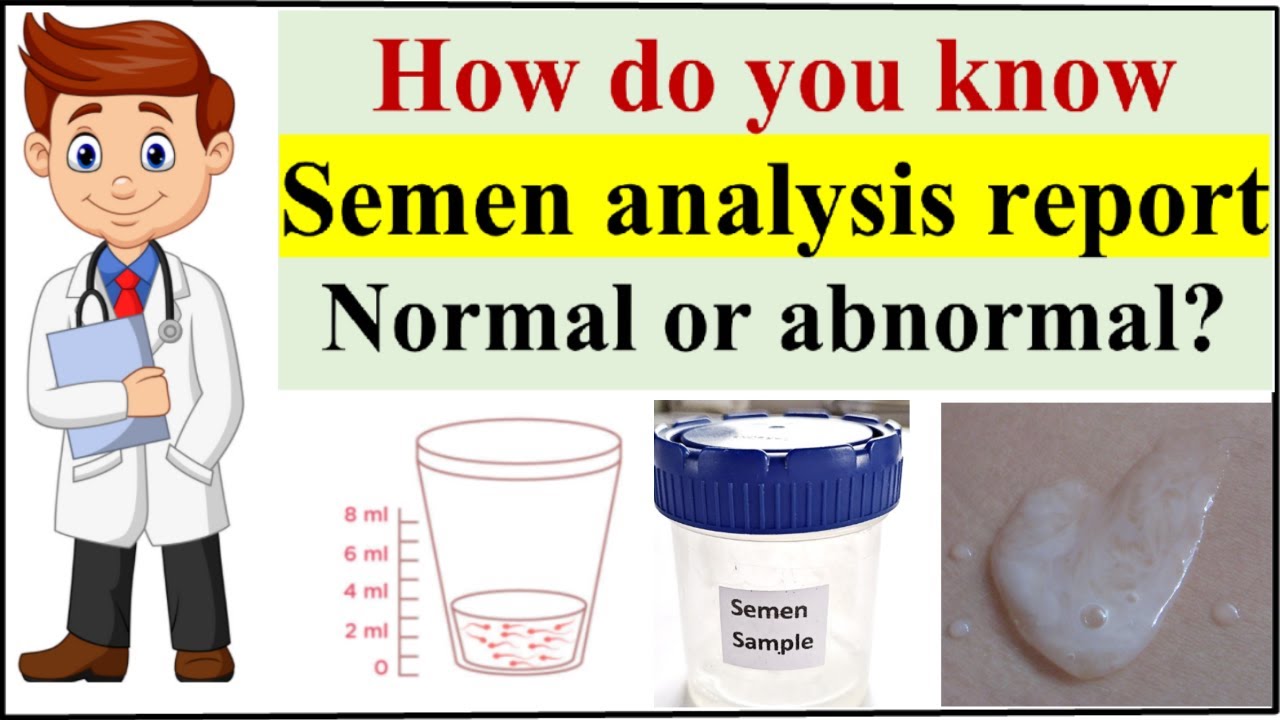 How to understand Semen analysis test report easily. sperm analysis ...