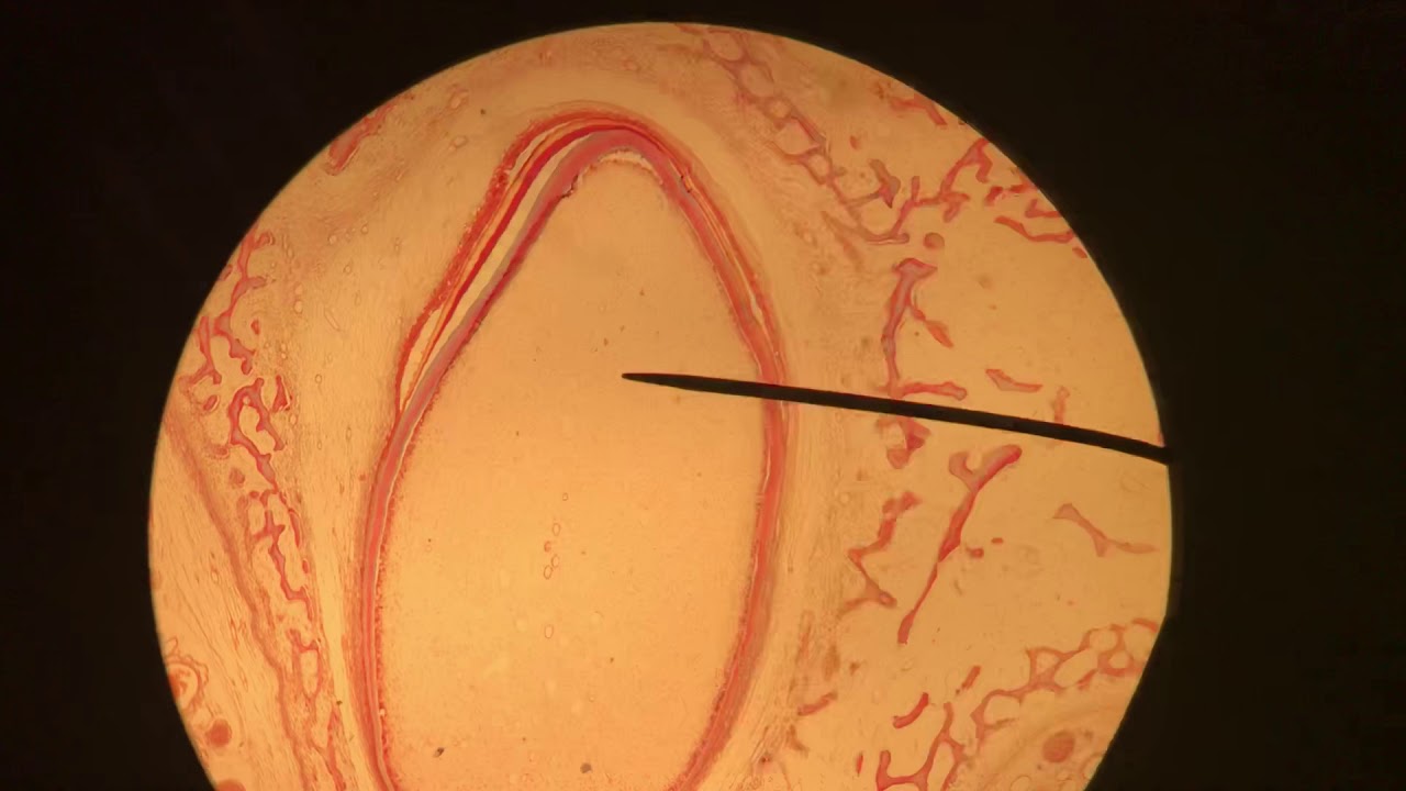 Developing tooth slide - YouTube